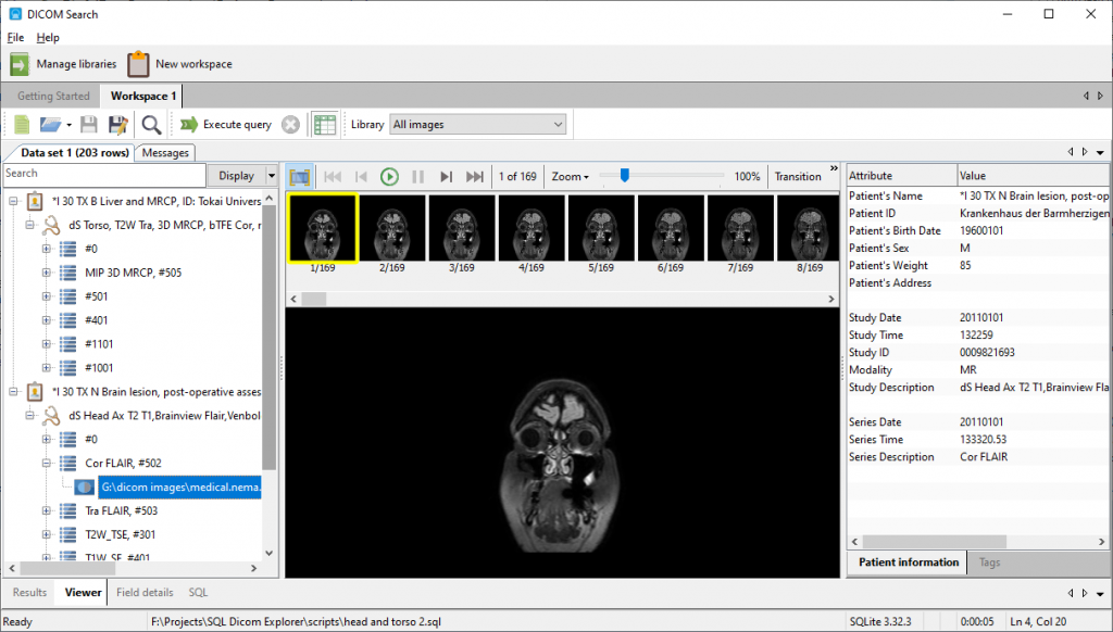 DICOM Search walk-through (preview) | Yohz Software Development Blog