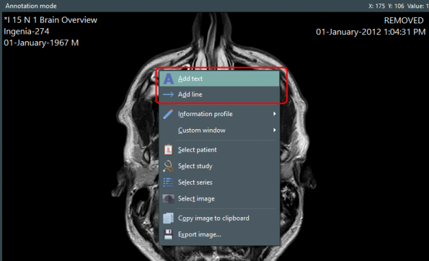 Annotating your DICOM images | Yohz Software Development Blog