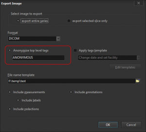 Anonymizing and editing DICOM tags | Yohz Software Development Blog